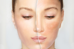 AGEs蓄積量チェック – CELL LABO丨細胞ヘルスケア研究所